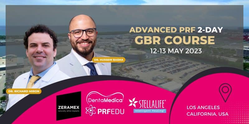 Zirconia vs Titanium Implants: The Differences - Zeramex USA